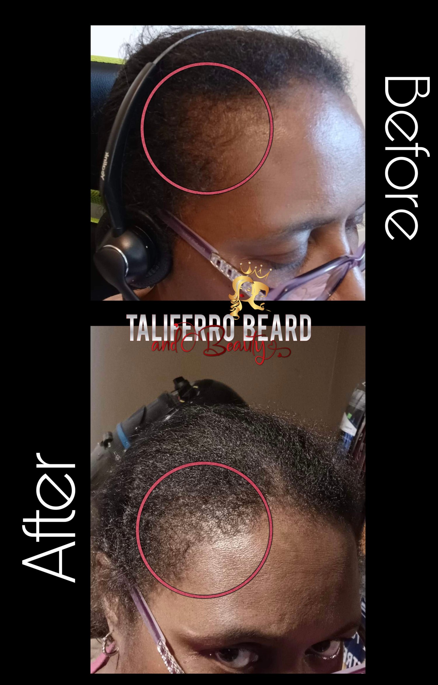 Taliferro Hair Growth Oil - Payhip