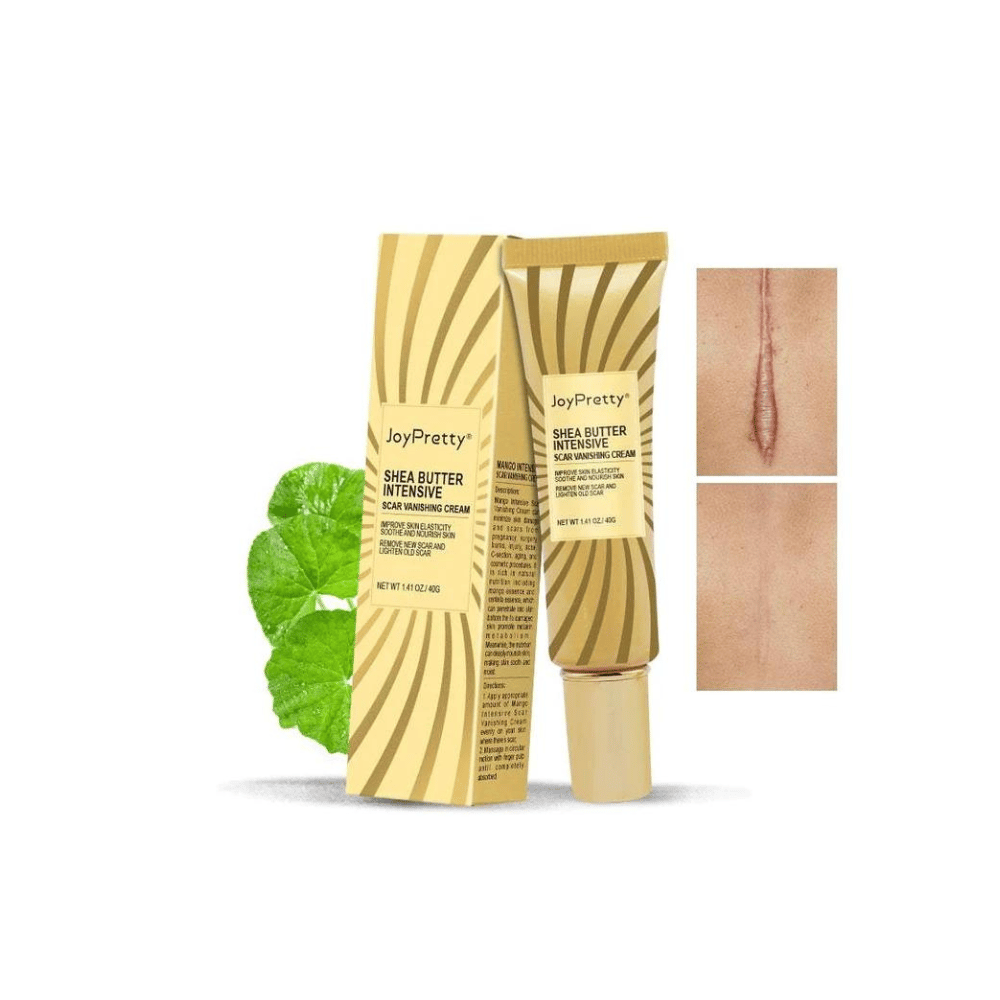 MANGO-SHEA BUTTER INTENSIVE SCAR REMOVAL CREAM - Payhip