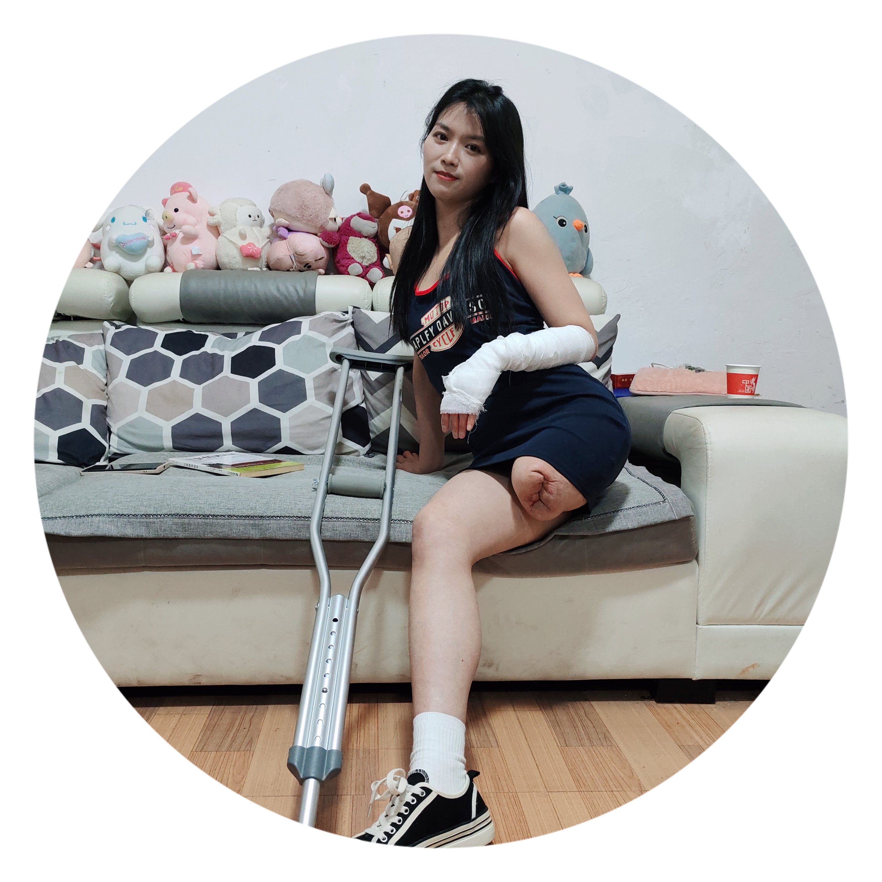 Alisa: Sak girl's hand is injured - Payhip