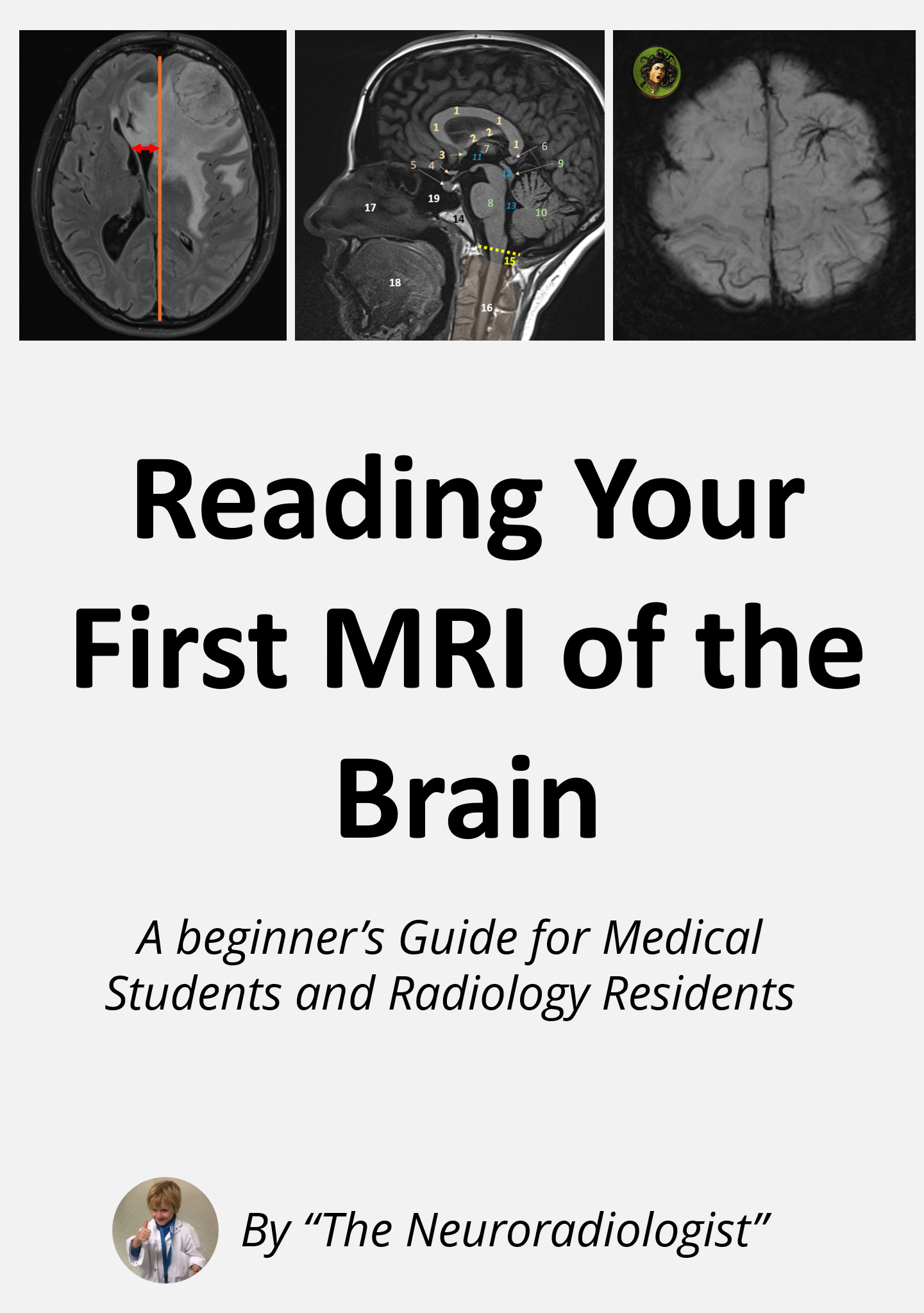 EBOOK: How to read your first brain MRI. - Payhip