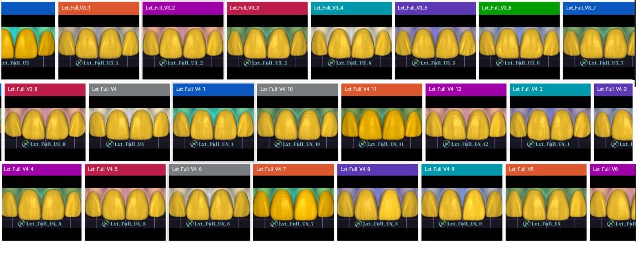 LXT TEETH LIBRARY EXOCAD - Payhip