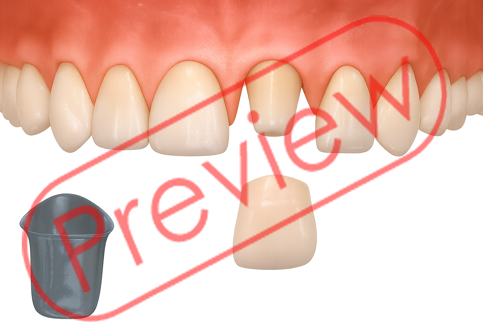 Dental Figure 663 Crowns and bridge - Payhip