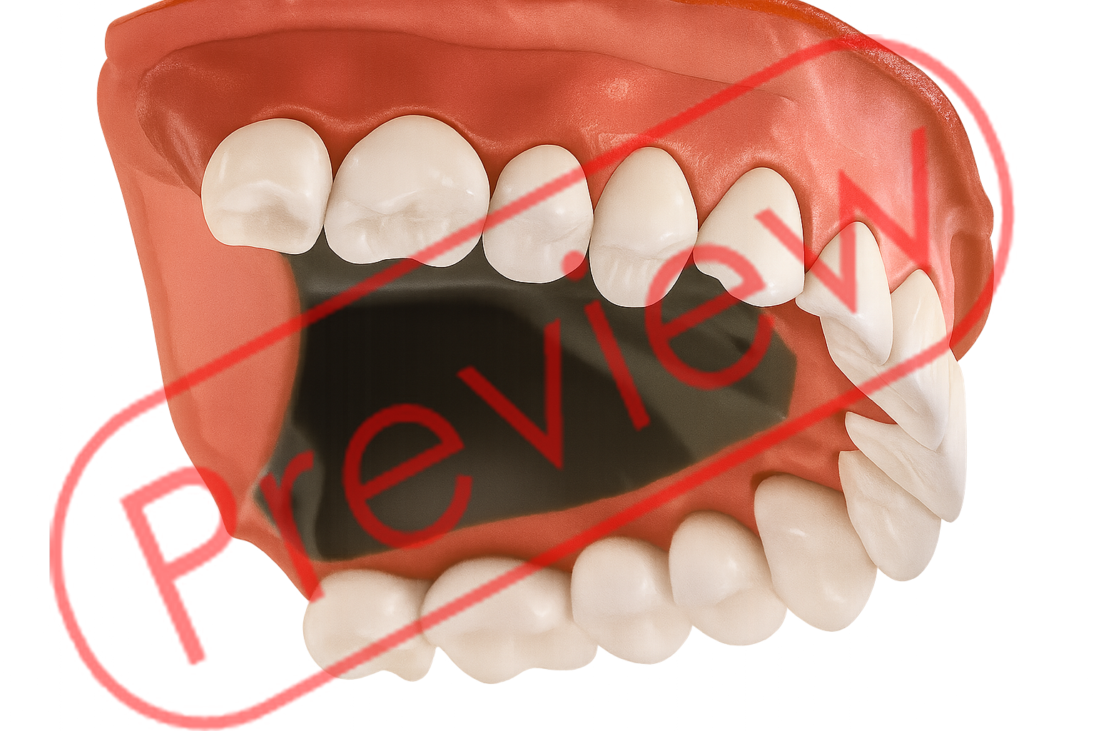 Dental Figure 83 Denture - Payhip