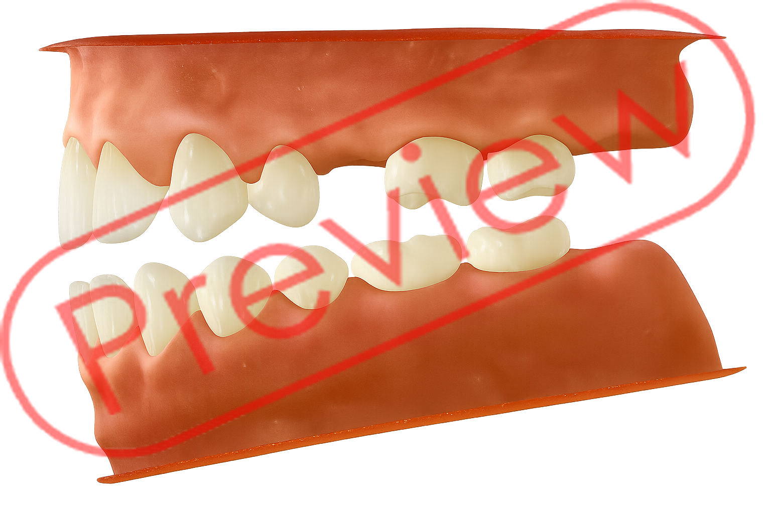 Dental Figure 7591 Molars - Payhip