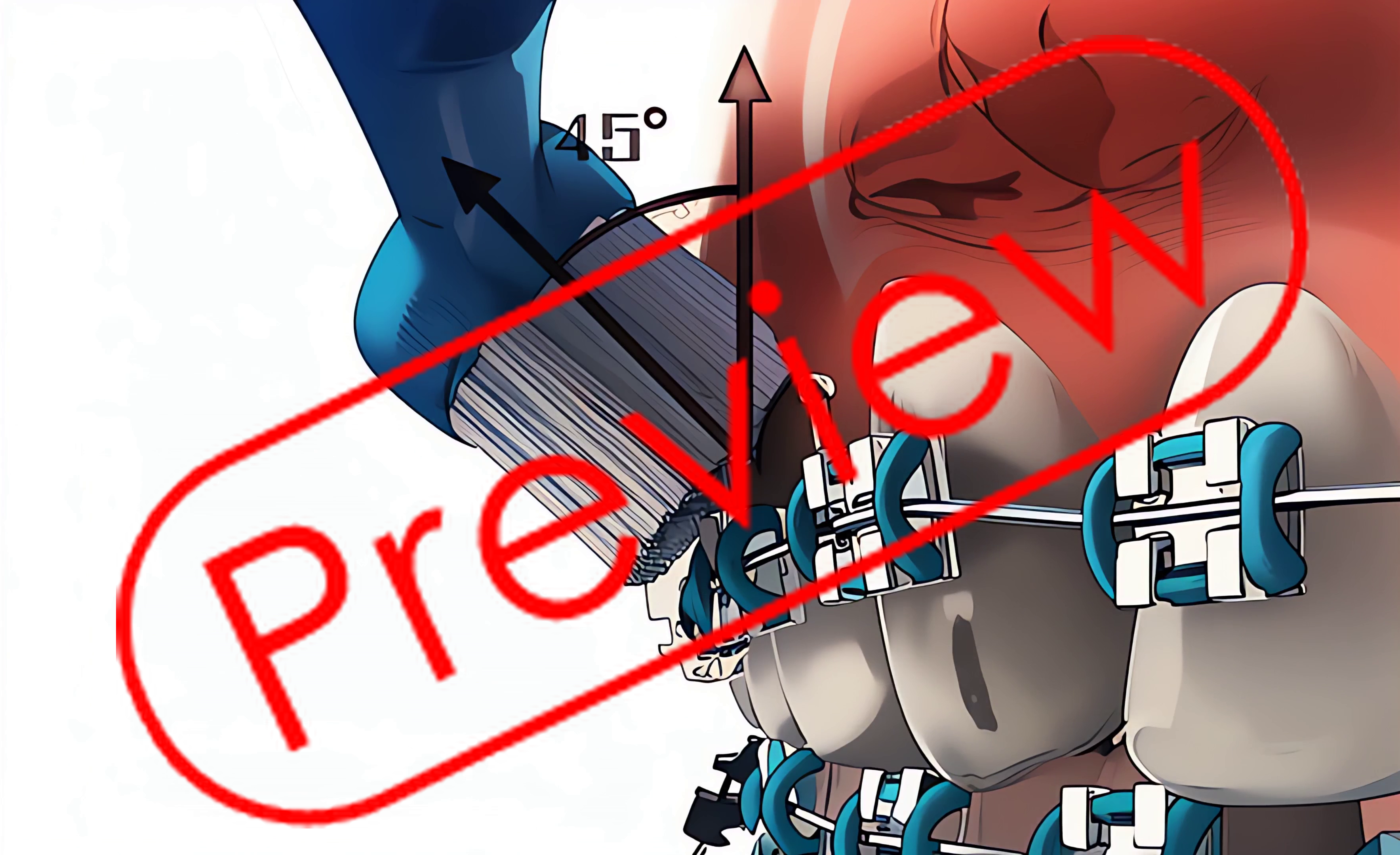 Dental Anime Orthodontics 01x - Payhip