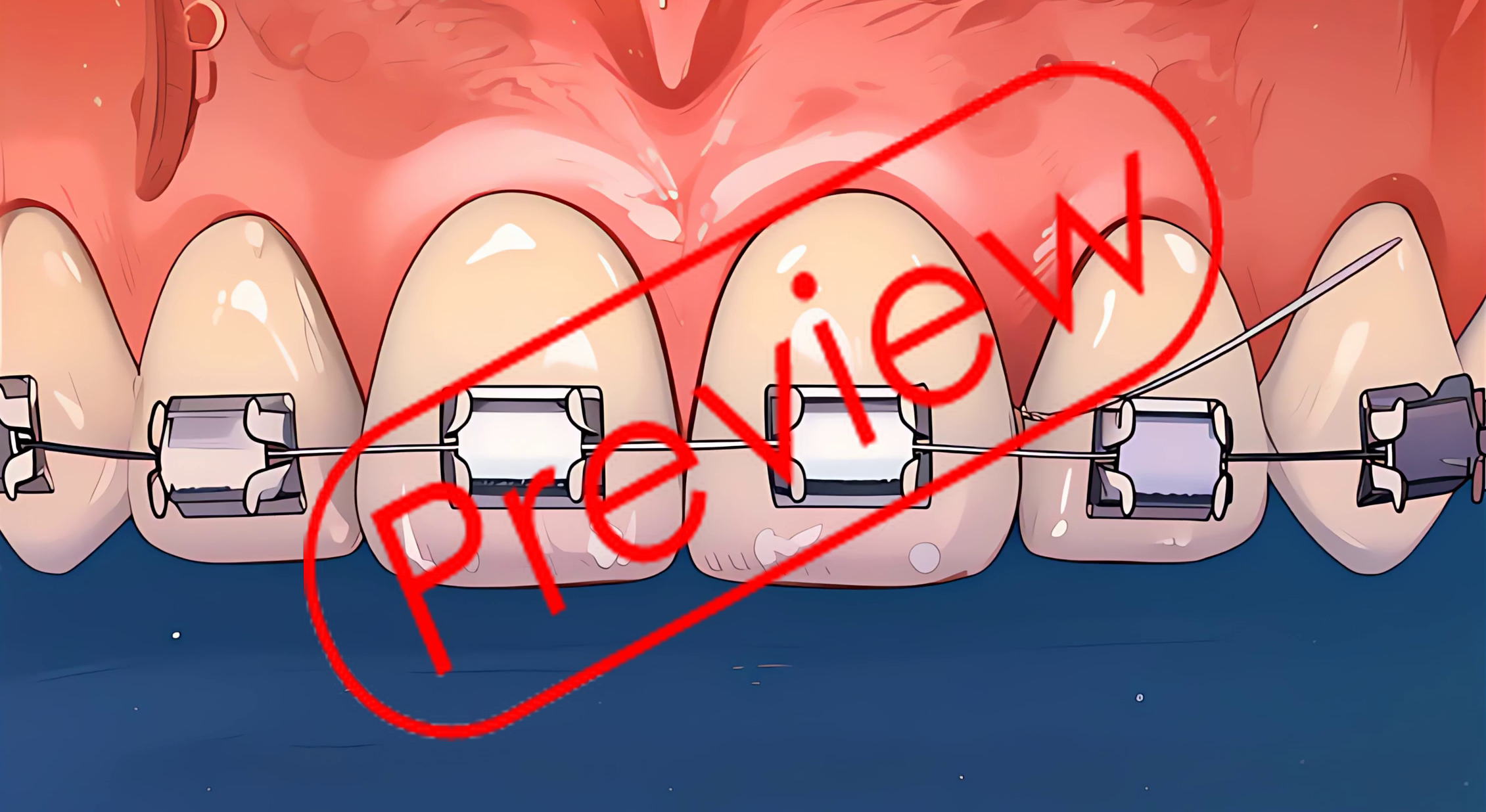 Dental Anime Orthodontics Hygiene 32g5 - Payhip