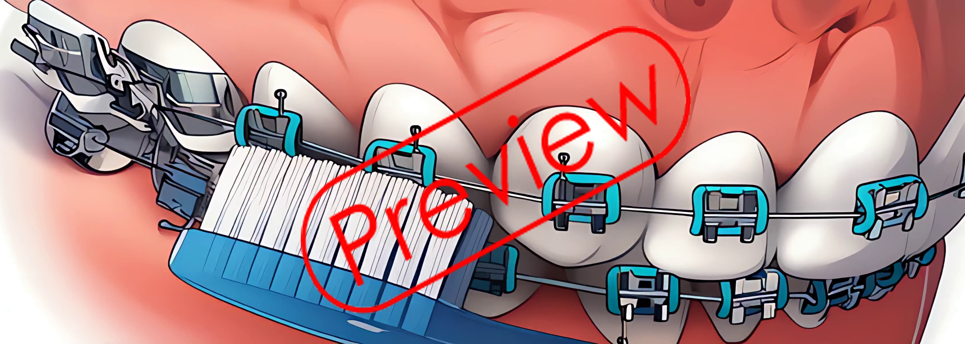 Dental Anime Orthodontics Hygiene 7t5 - Payhip