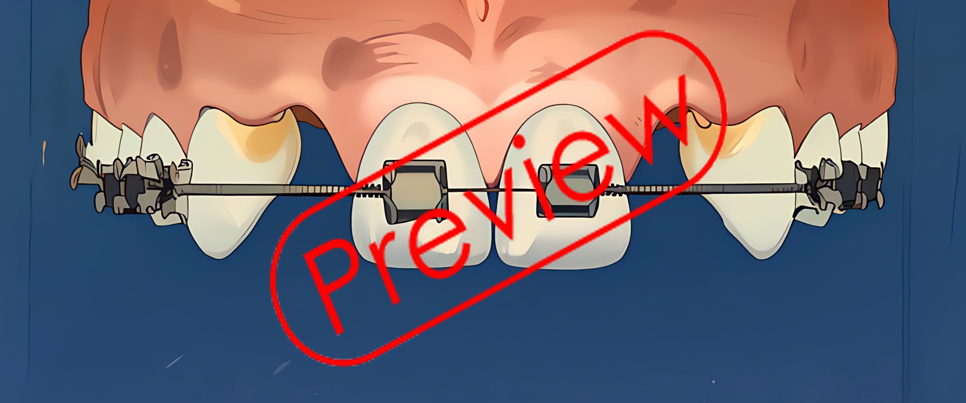 Dental Anime d2332 - Payhip