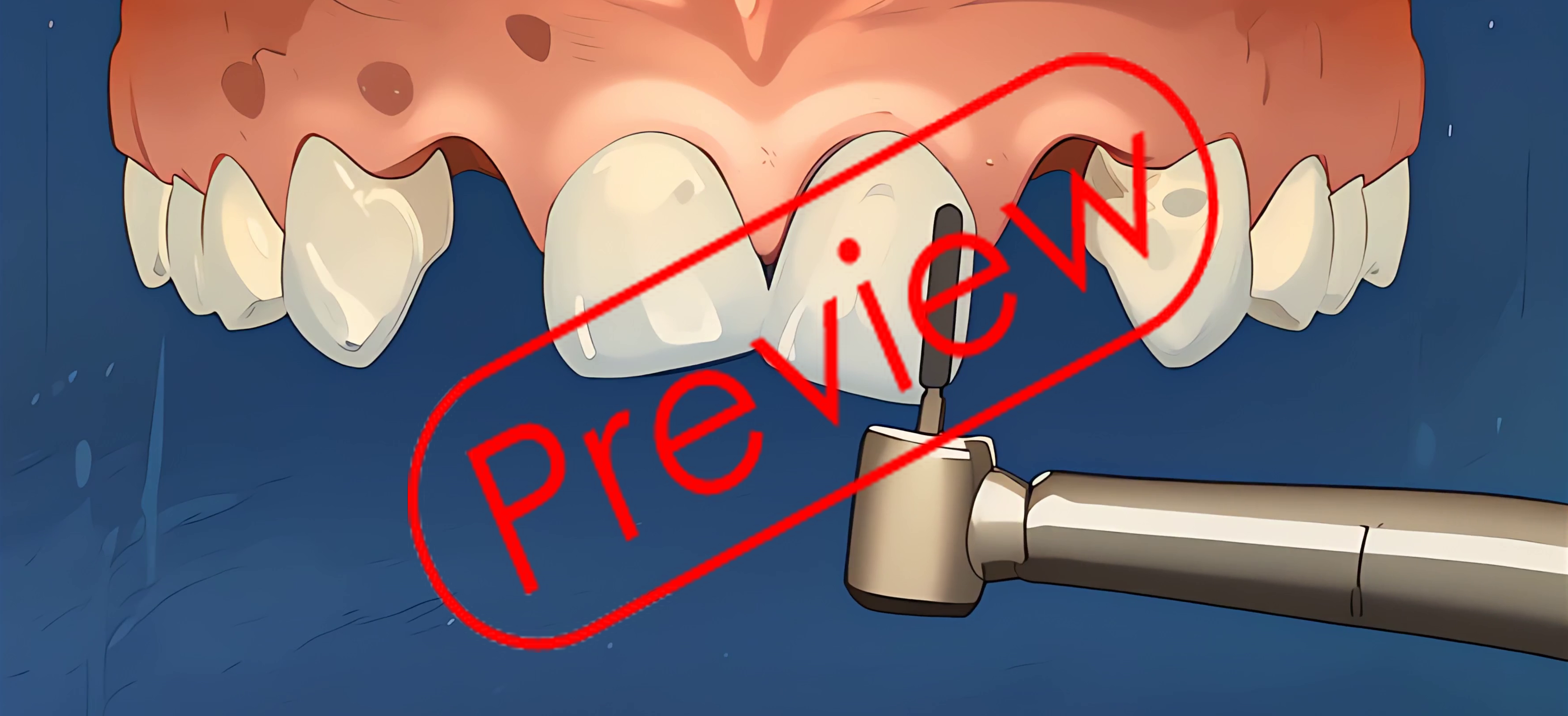 Dental Anime 3u3 - Payhip