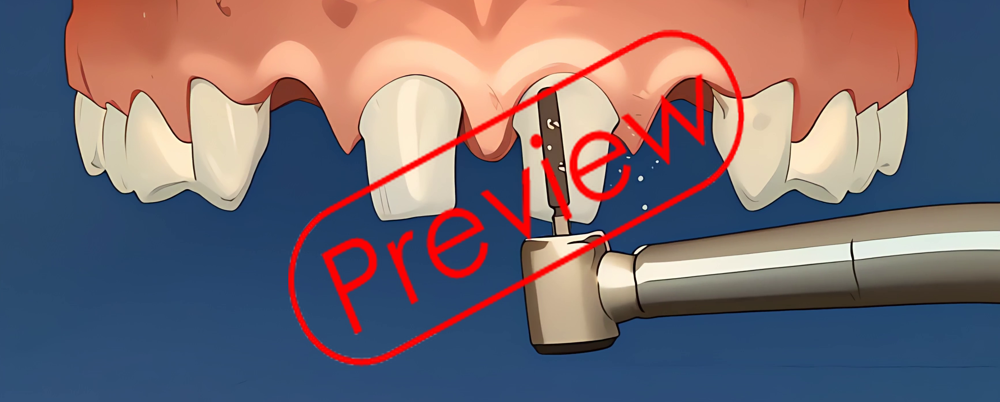 Dental Anime 3uw - Payhip