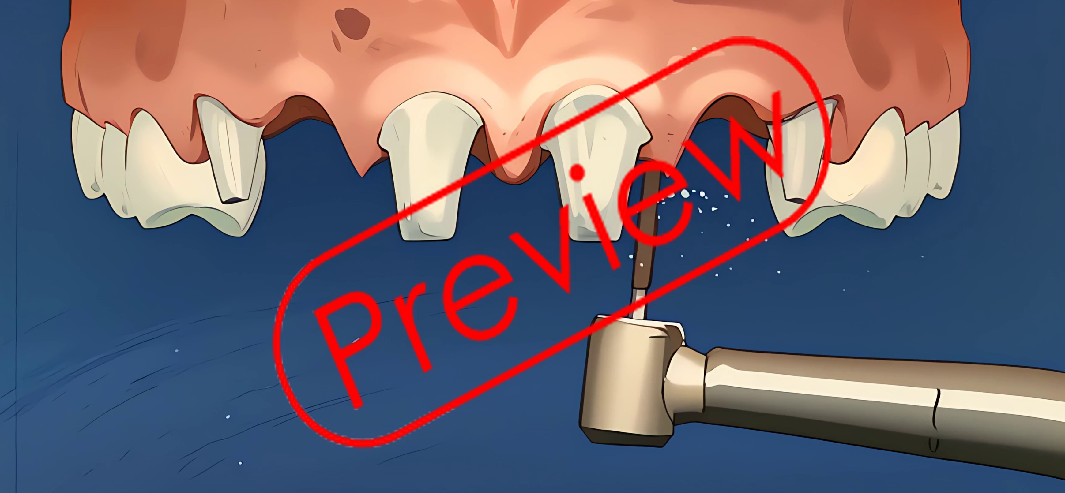 Dental Anime 3uw2 - Payhip
