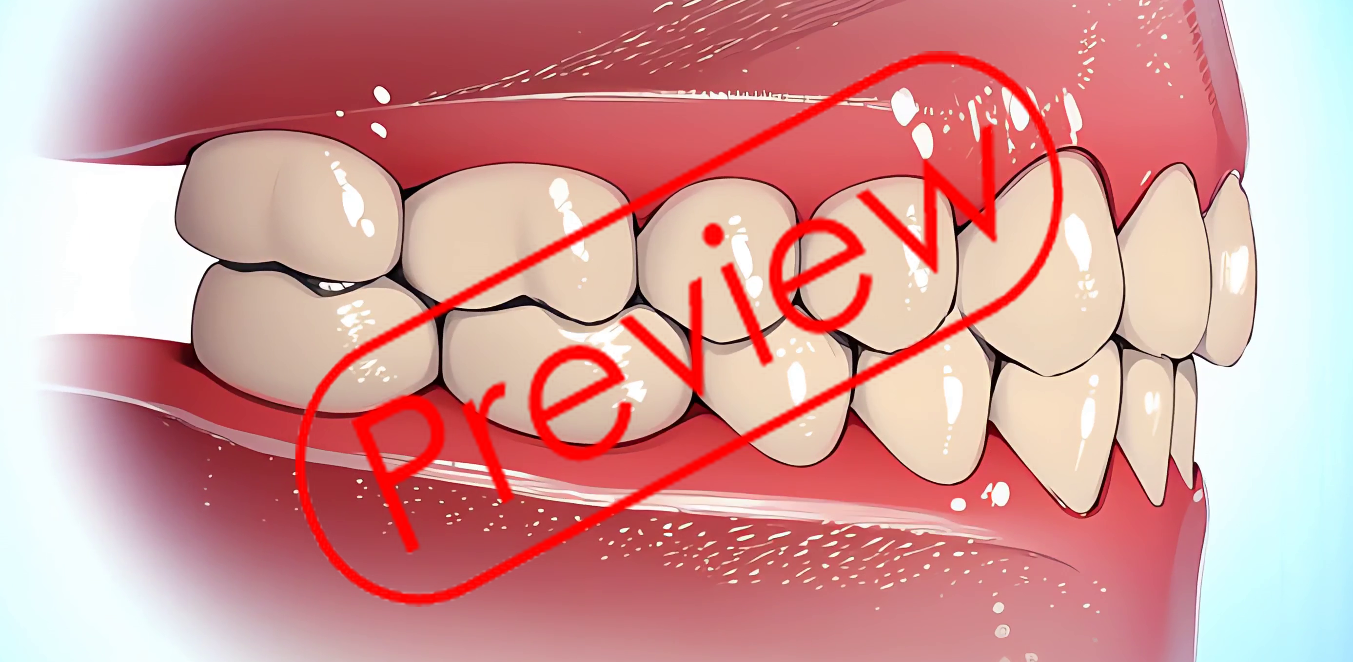 Dental Anime Orthodontics Aligners u5 - Payhip