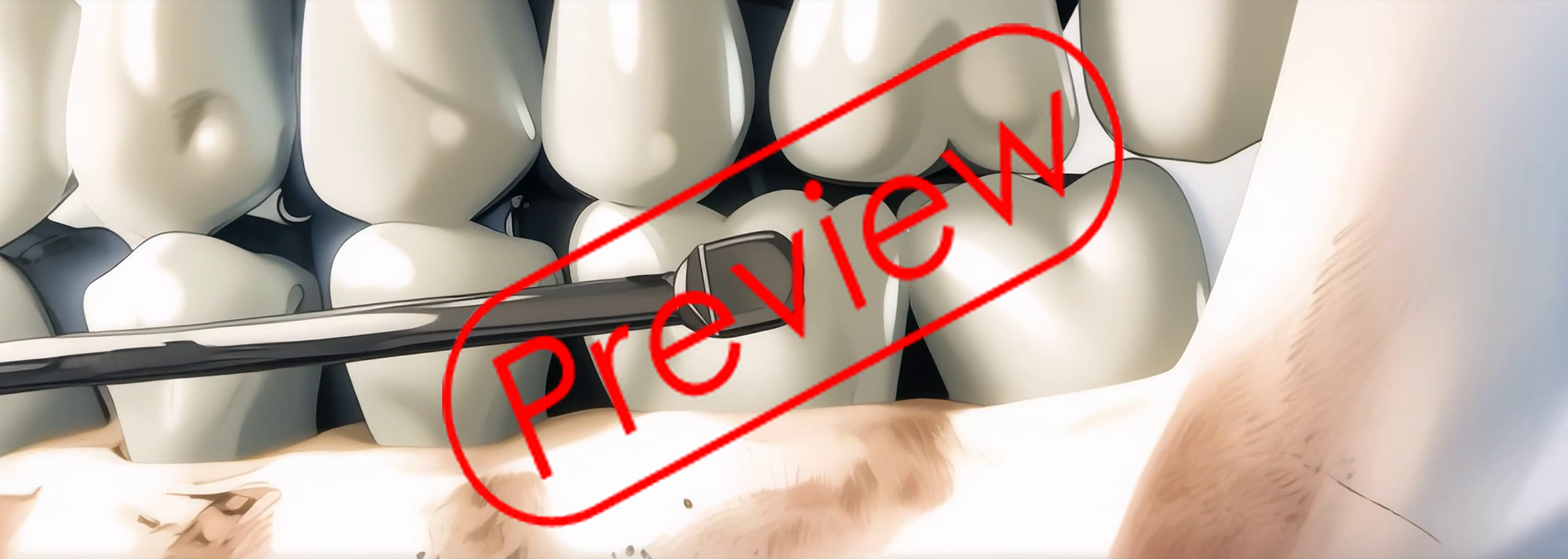 Dental Anime Orthodontics Surgery u92u - Payhip