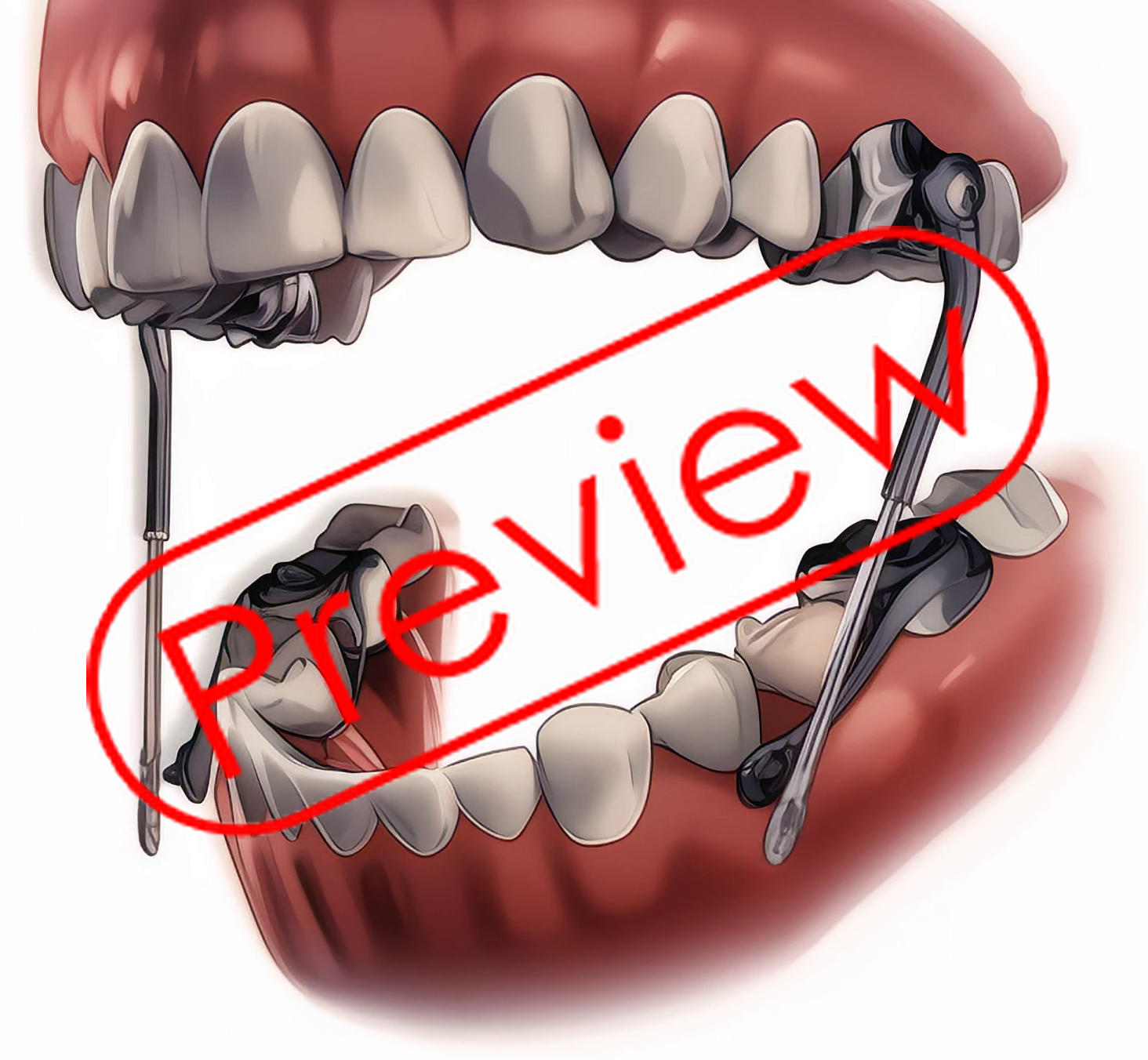 Dental Anime Orthodontics u3xx9 - Payhip