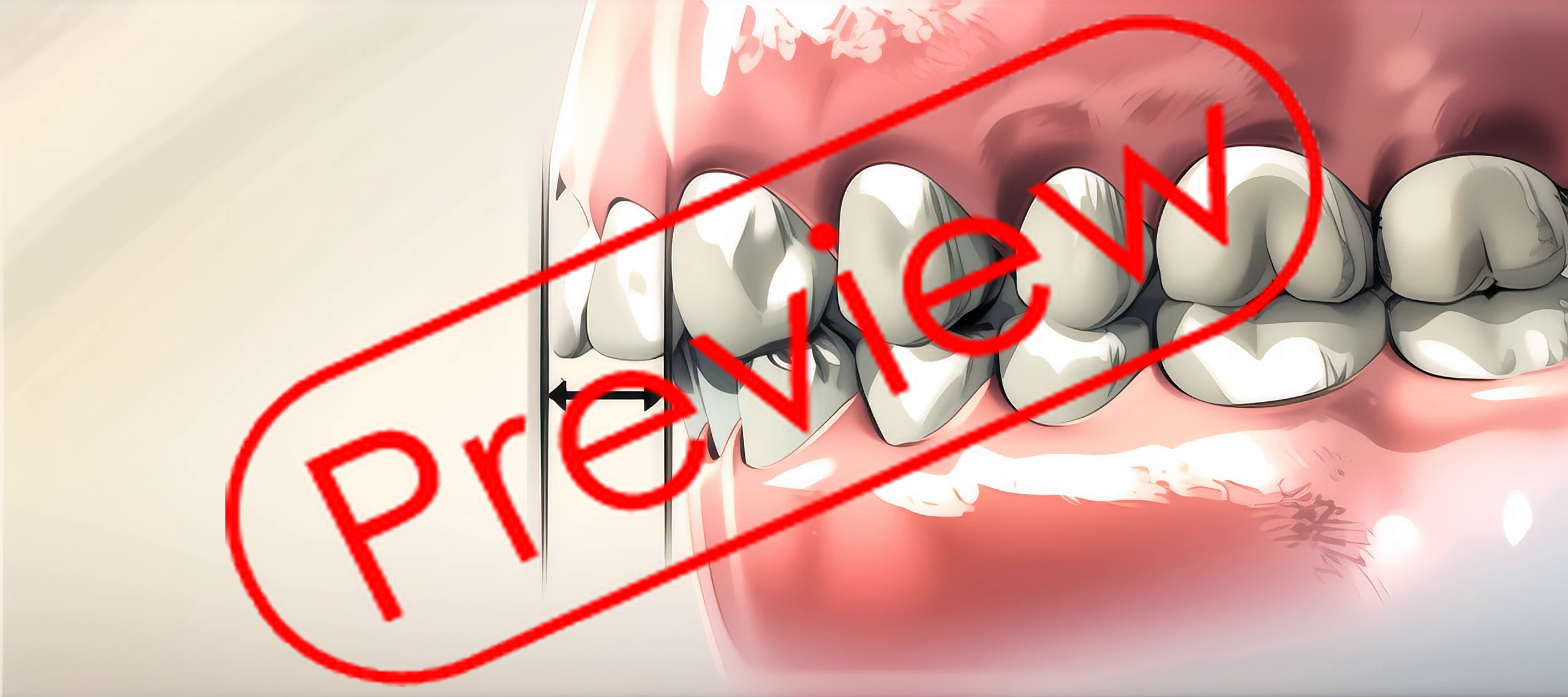 Dental Anime Orthodontics 0j4 - Payhip