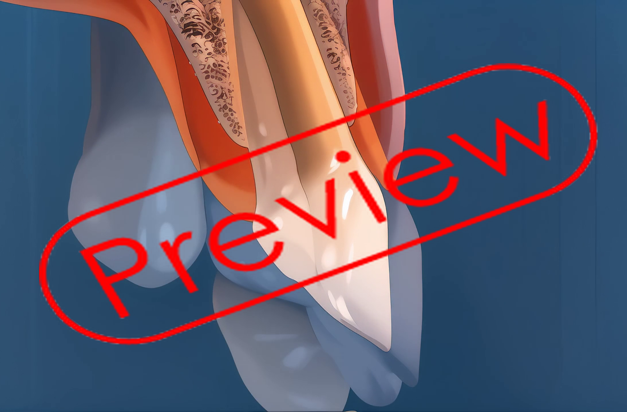 Dental Anime k4 - Payhip