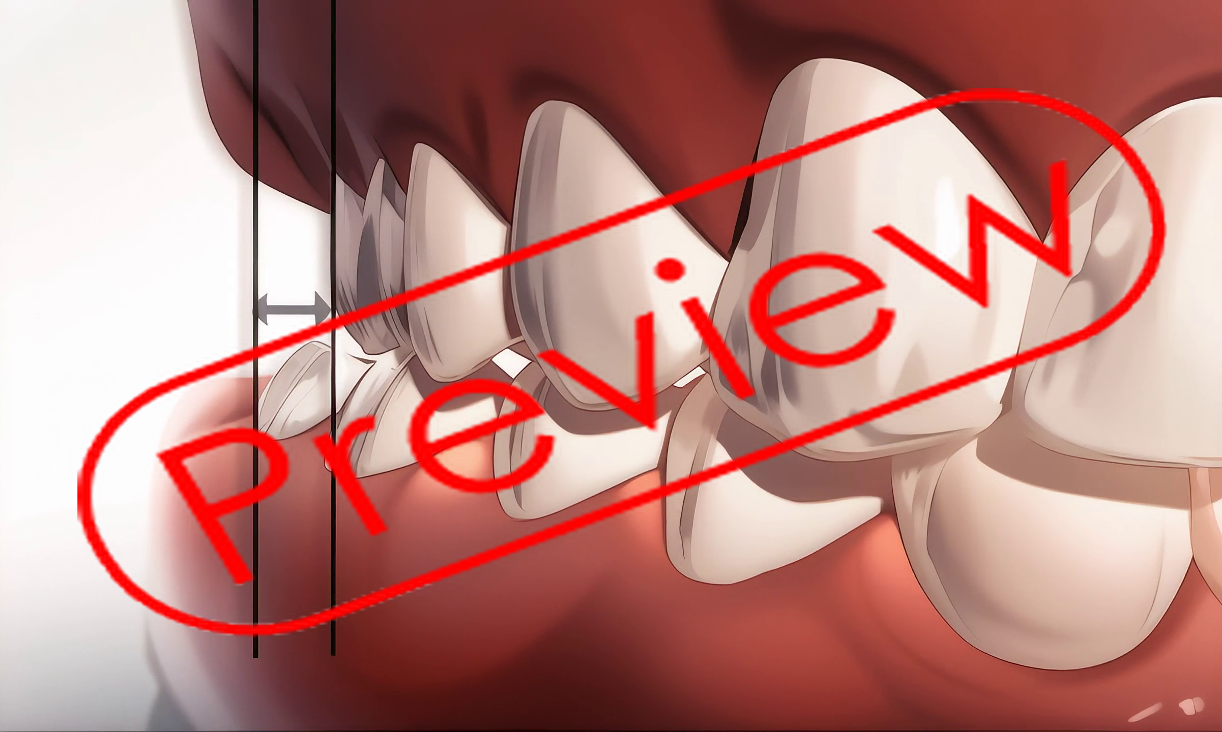 Dental Anime Orthodontics mfw3 - Payhip