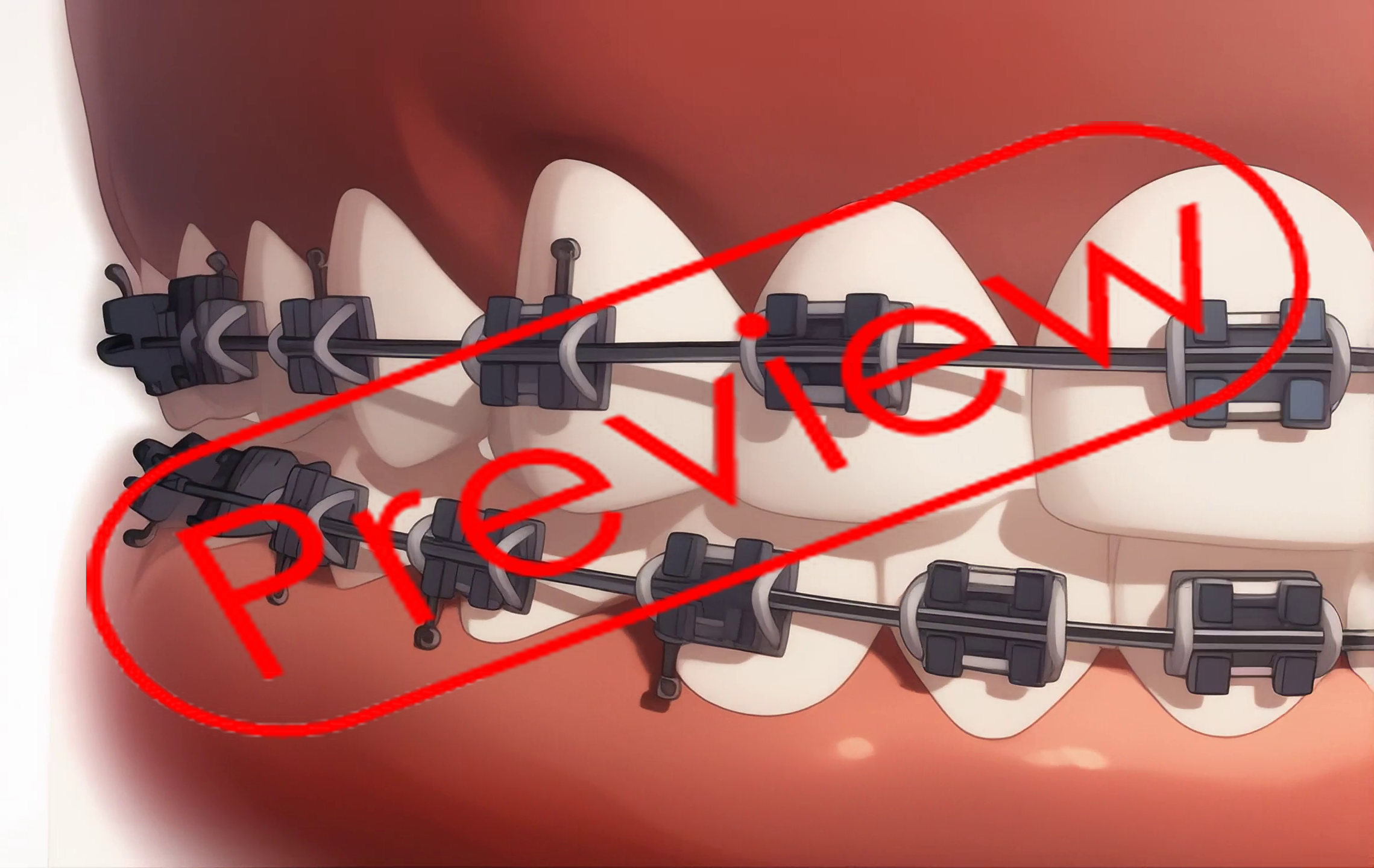 Dental Anime Orthodontics x27h92g - Payhip