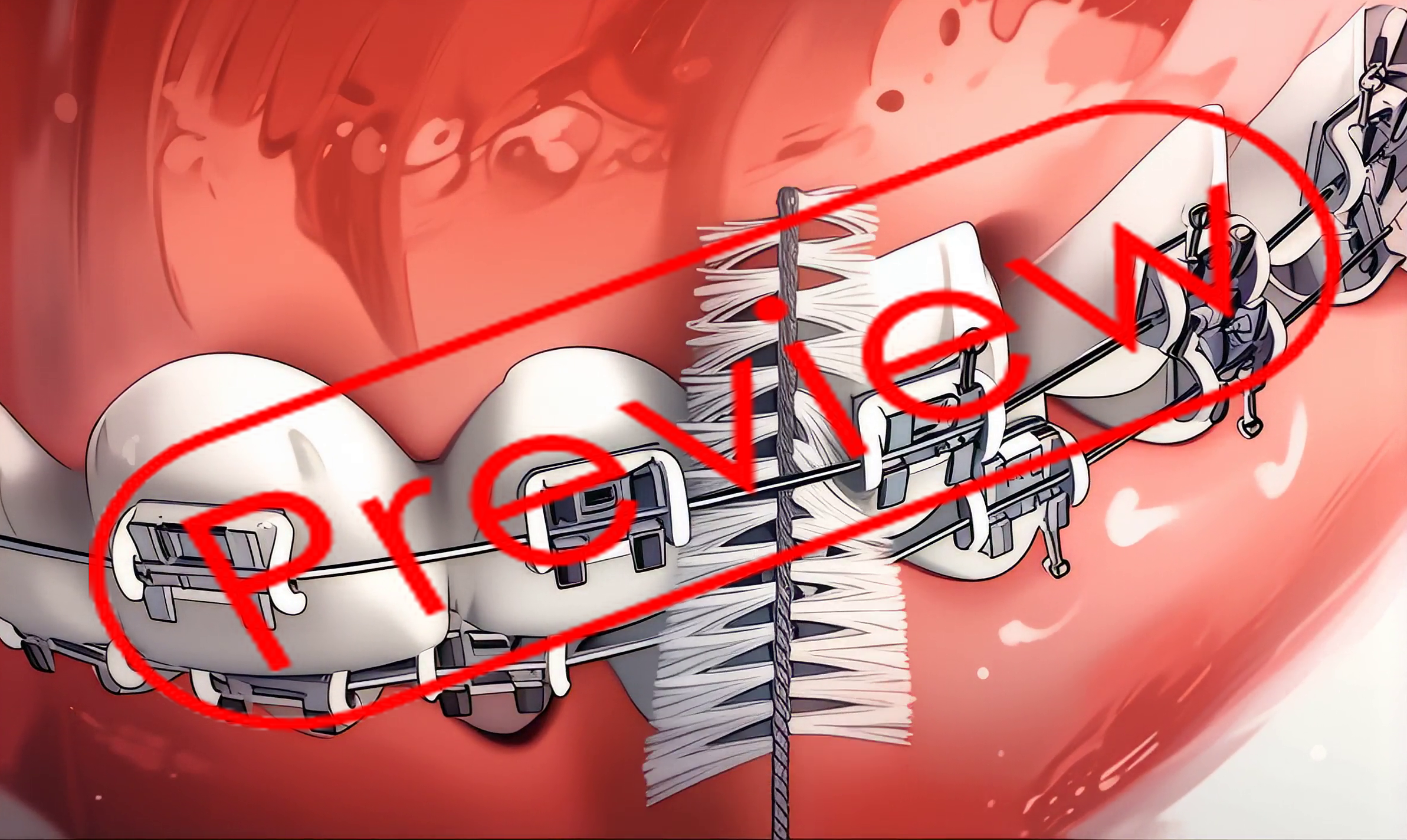 Dental Anime Orthodontics 01zv4 - Payhip