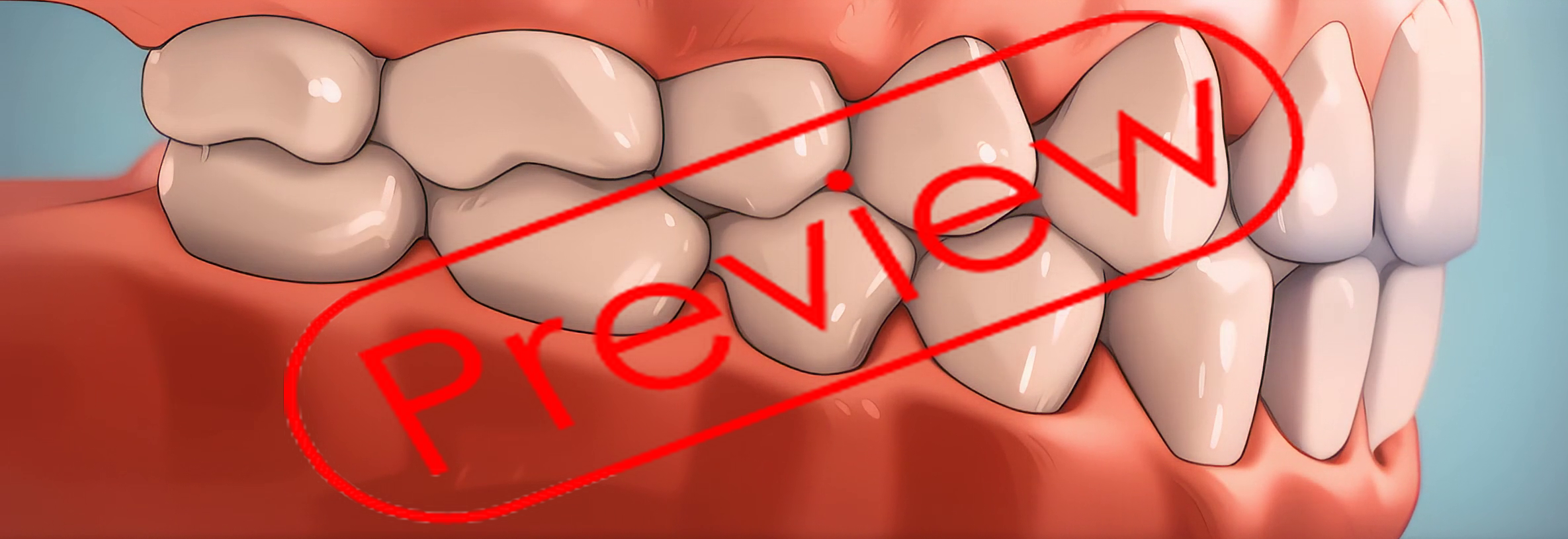 Dental Anime Orthodontics 00b8xx6 - Payhip
