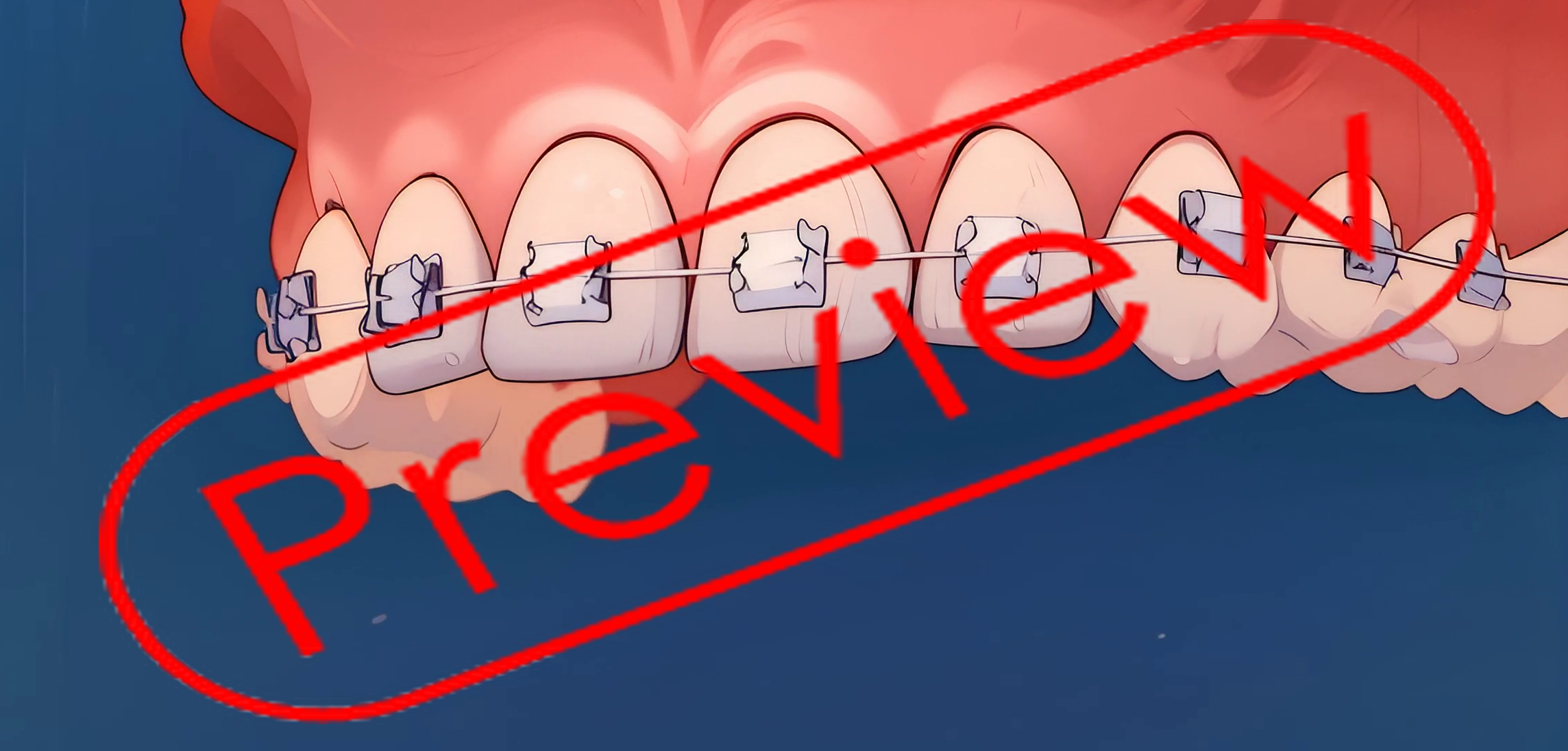 Dental Anime Orthodontics 063 - Payhip