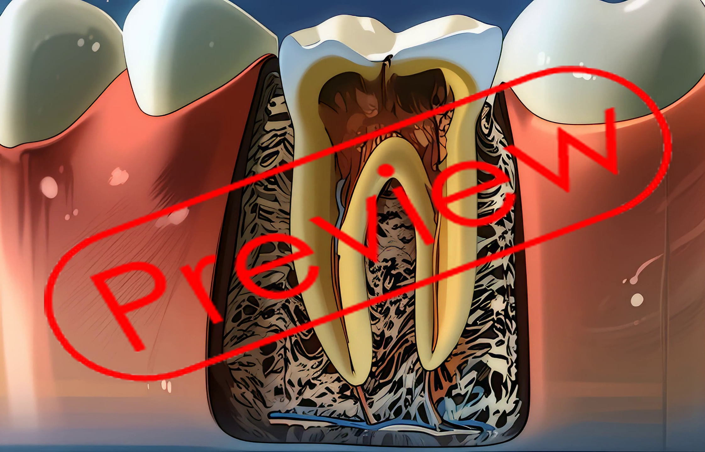 Dental Anime Endodontics onb1 - Payhip