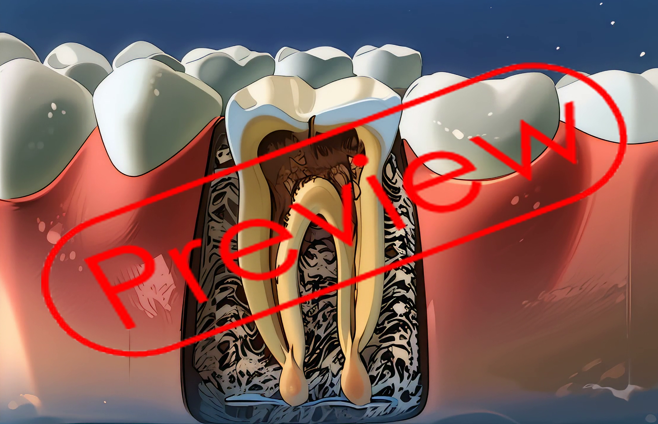 Dental Anime Endodontics oh14x - Payhip