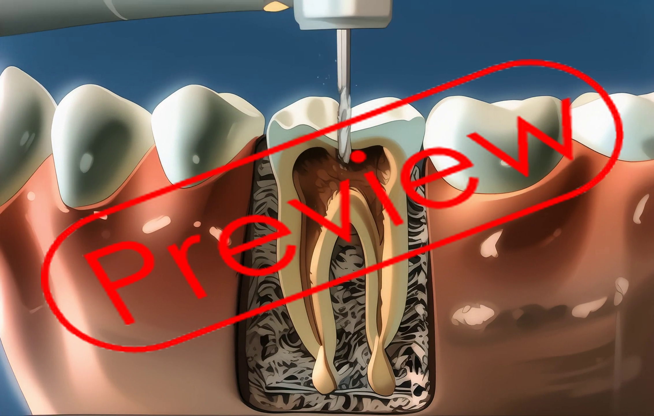 Dental Anime Endodontics o3 - Payhip