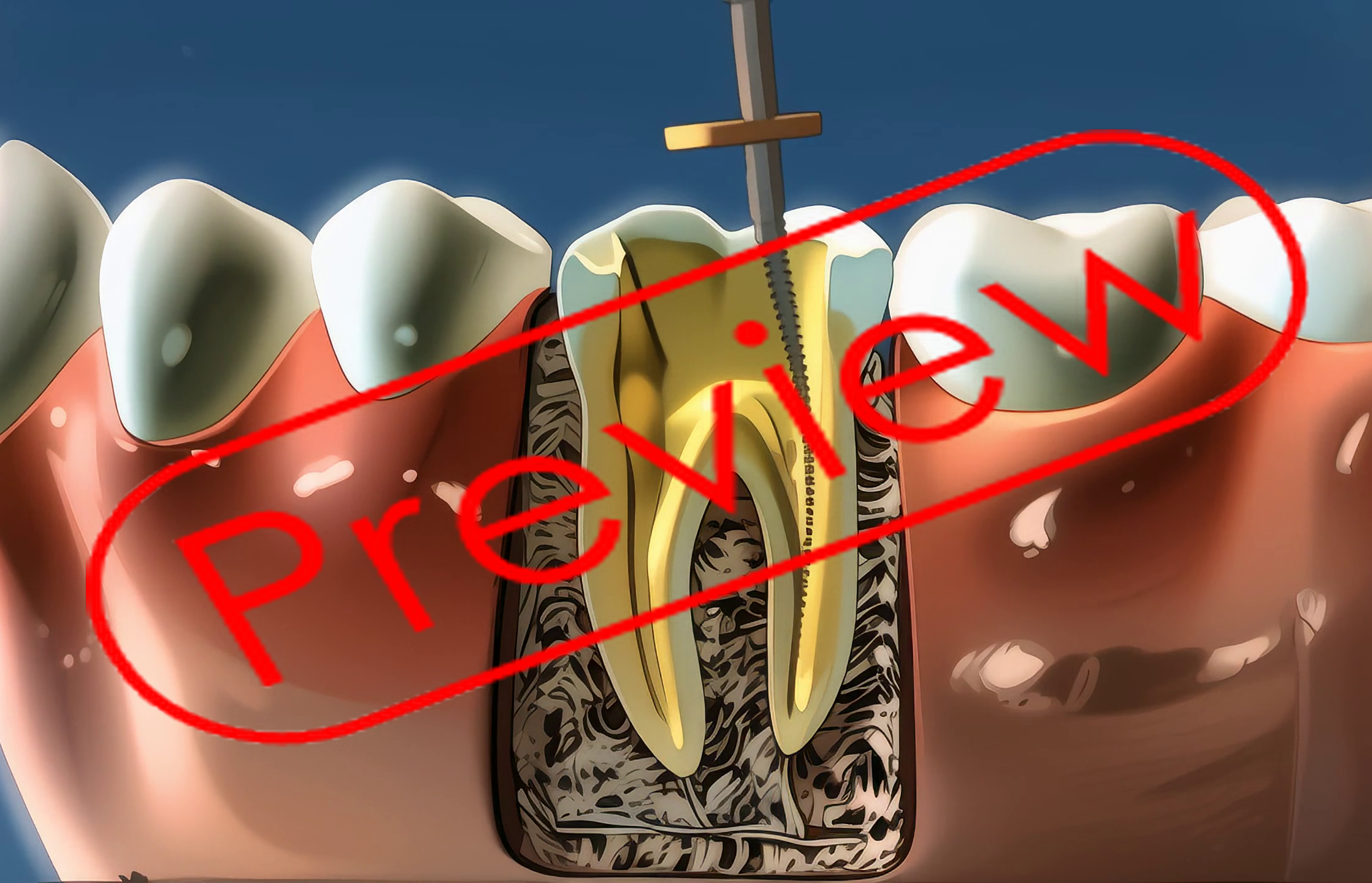 Dental Anime Endodontics o9x7x - Payhip
