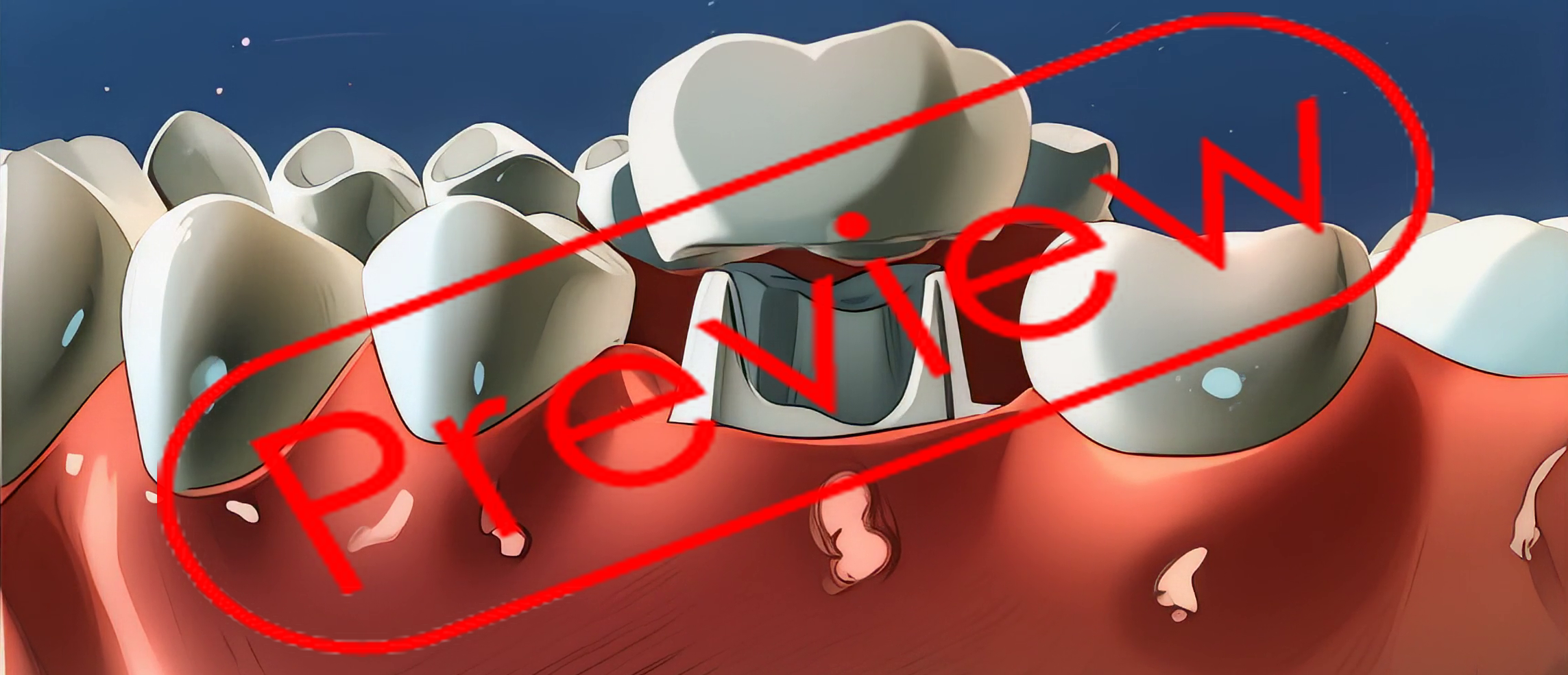 Dental Anime Endodontics v80x26 - Payhip