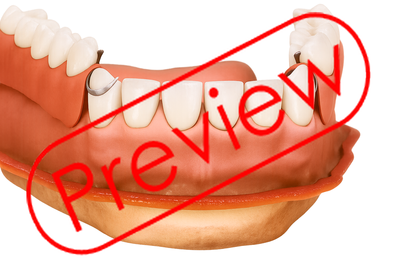 Denture h4s - Payhip