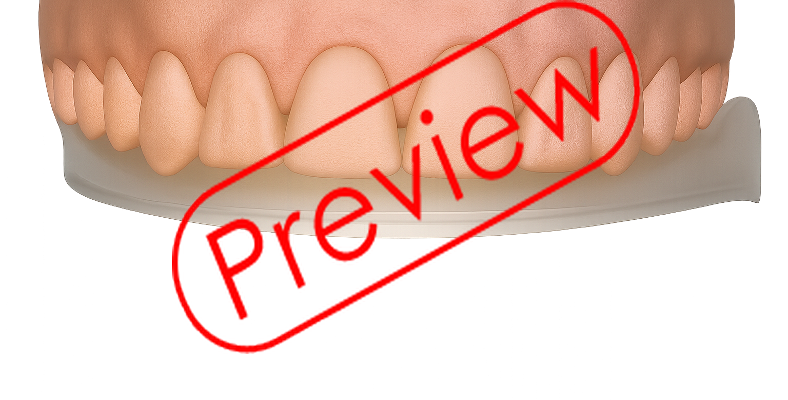Orthodontics Aligners 5u7 - Payhip