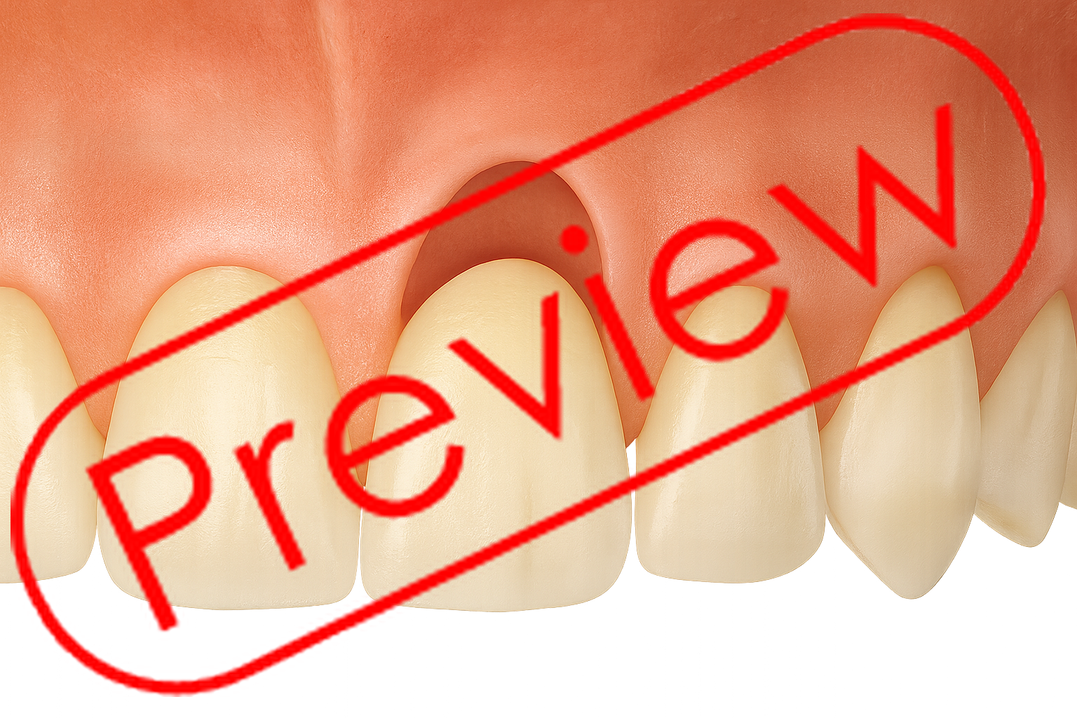 Periodontics ll27 - Payhip