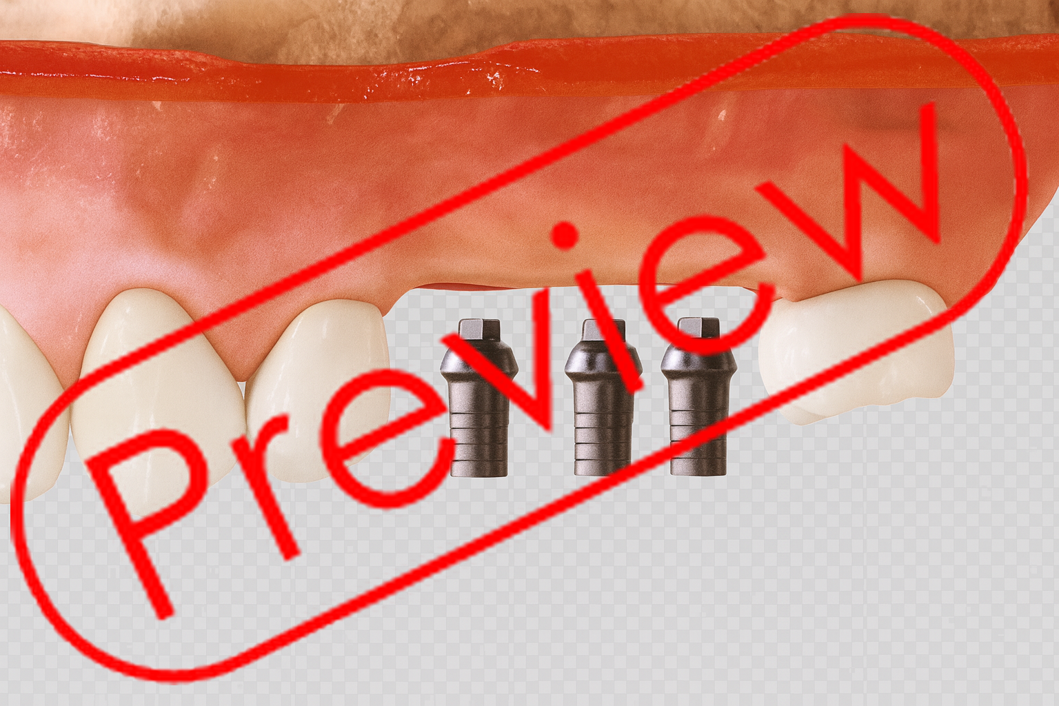 Periodontics fn4m5x1 - Payhip