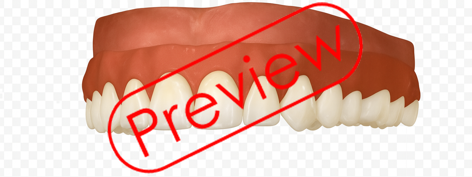 All on Full Restoration Implants 258b - Payhip